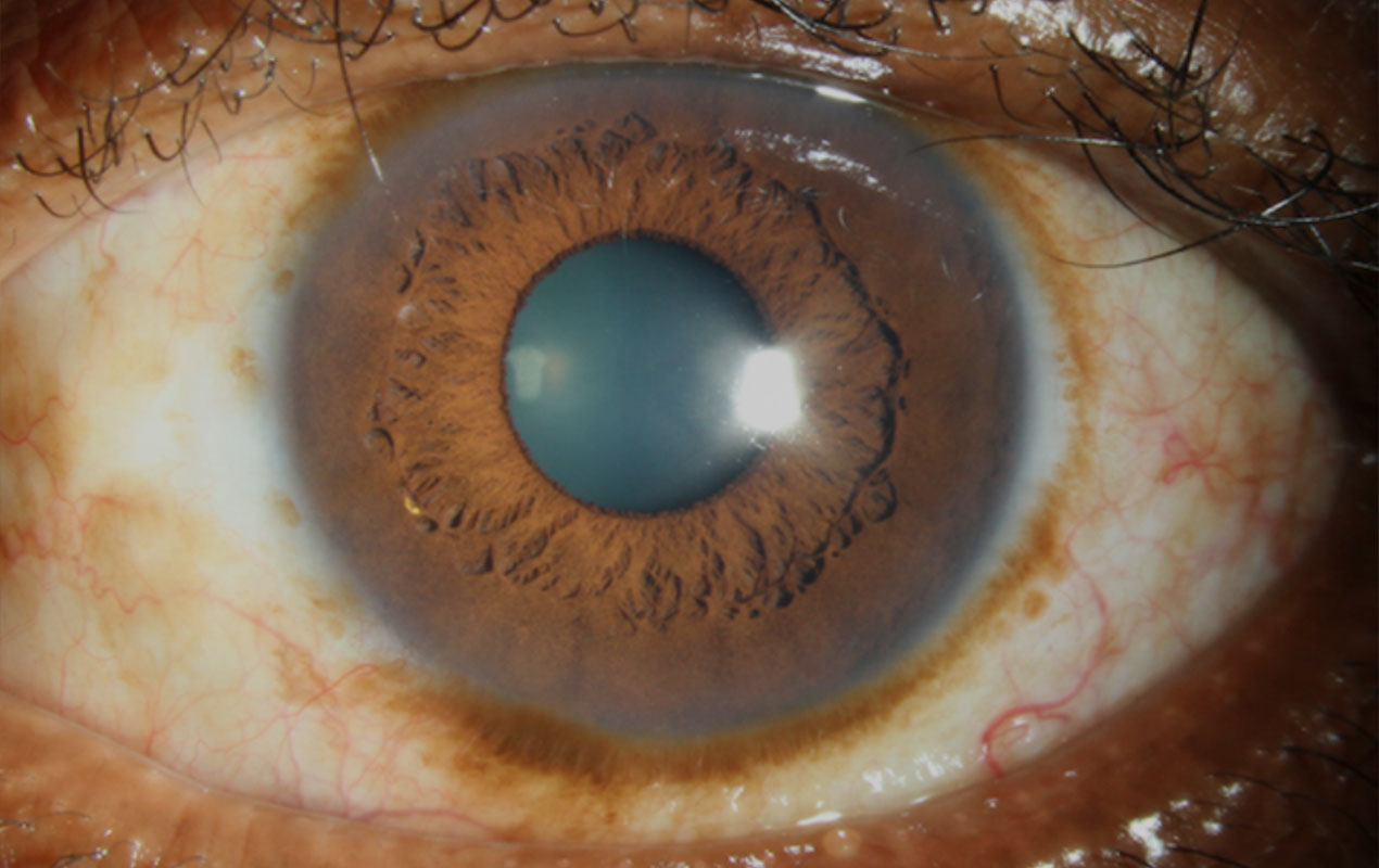 UVista SPF Eye Drops